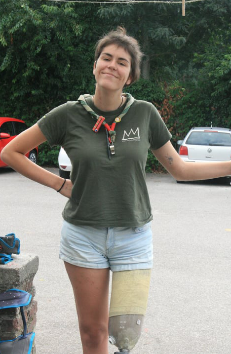 De beenprothese van Maël | Eqwal Ability